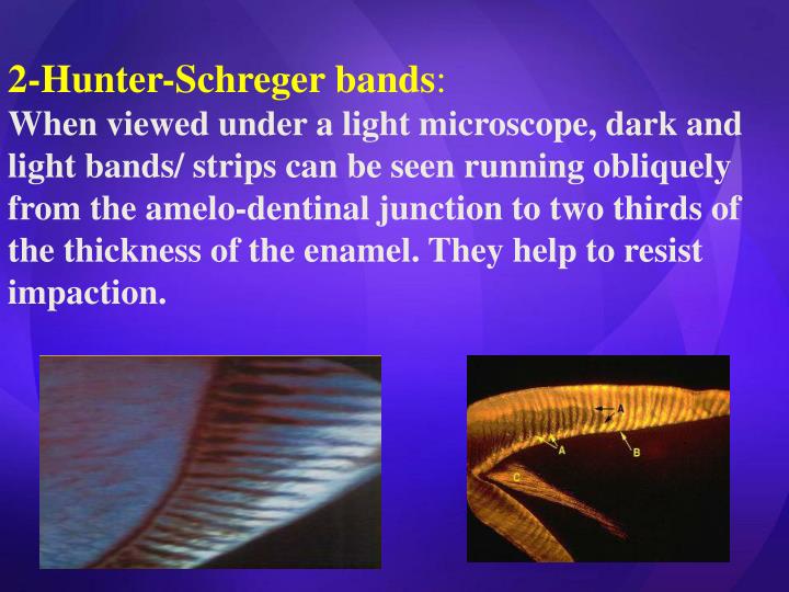 PPT - TOOTH ENAMEL PowerPoint Presentation - ID:6725407