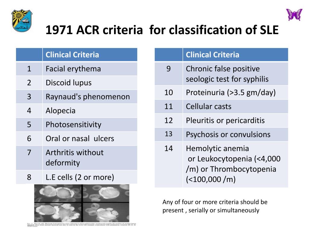 Ppt Systemic Lupus Erythematosus Internist Update Powerpoint