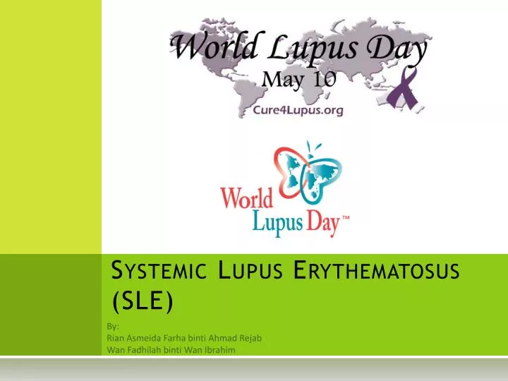 PPT - Systemic Lupus Erythematosus (SLE) PowerPoint Presentation, free ...