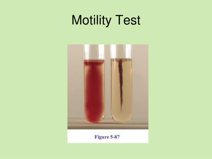 PPT - Microbiology Unknown Lab PowerPoint Presentation - ID:6730041