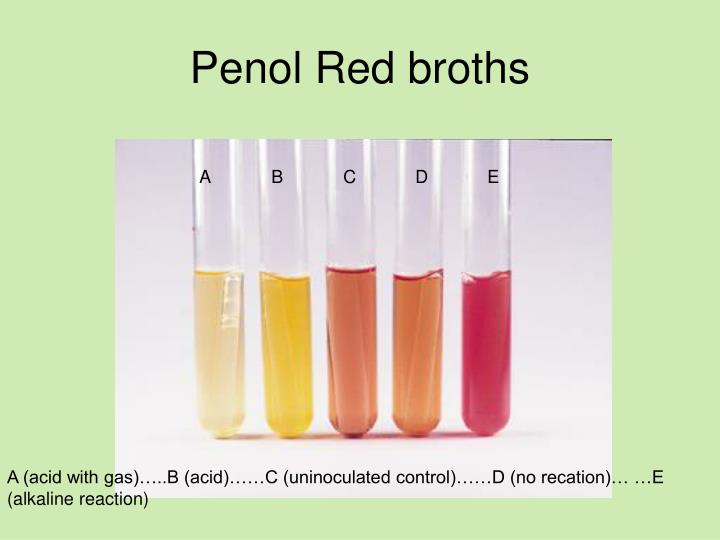 PPT - Microbiology Unknown Lab PowerPoint Presentation - ID:6730041