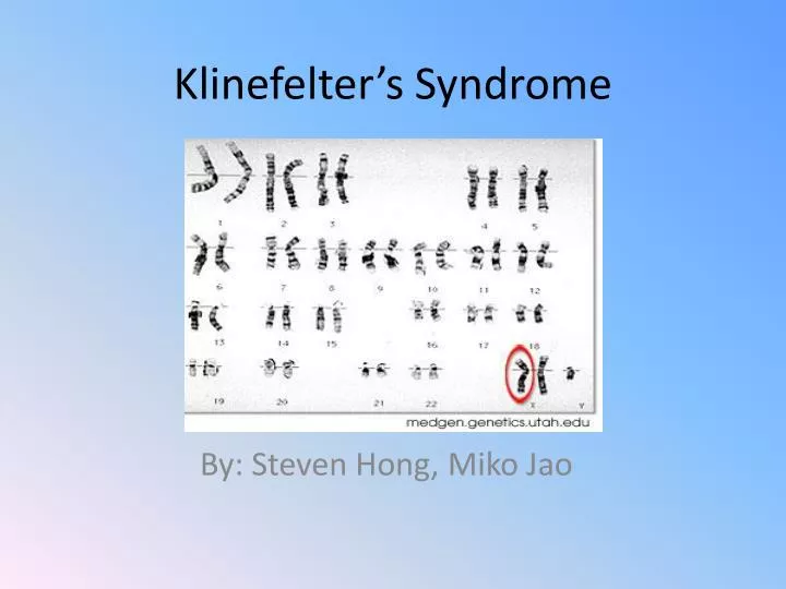 PPT - Klinefelter’s Syndrome PowerPoint Presentation, free download ...