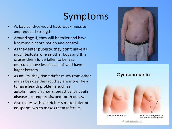 PPT - Klinefelter’s Syndrome PowerPoint Presentation - ID:6730569