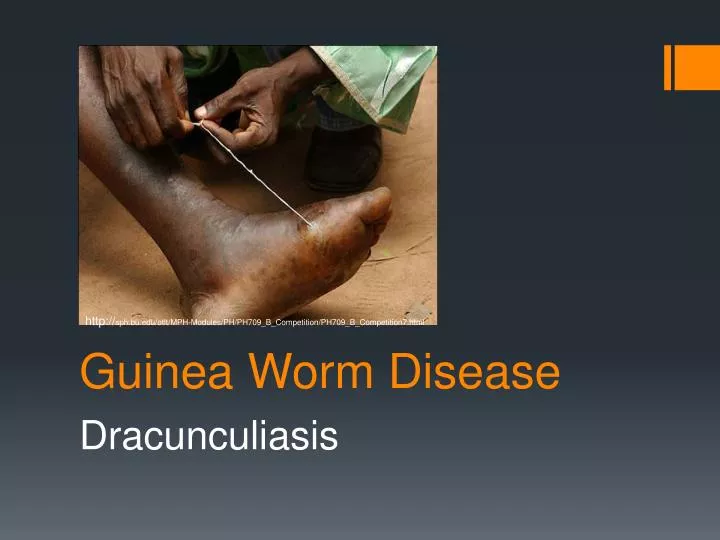 PPT - Guinea Worm Disease PowerPoint Presentation, free download - ID ...