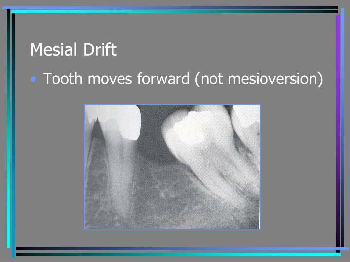 PPT - Occlusion PowerPoint Presentation - ID:6736052