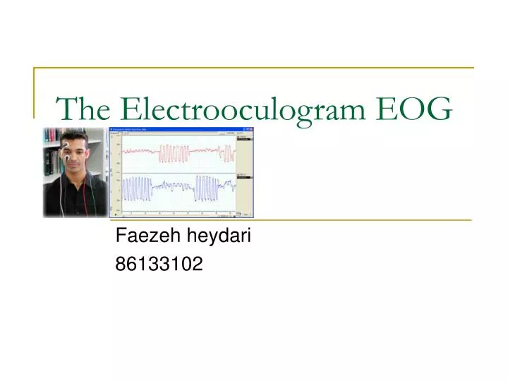 PPT - The Electrooculogram EOG PowerPoint Presentation, free download ...