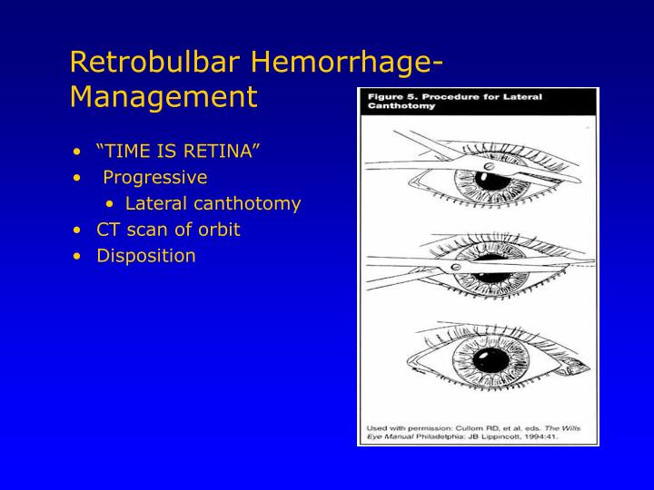 PPT - Orbital Trauma PowerPoint Presentation - ID:6737616