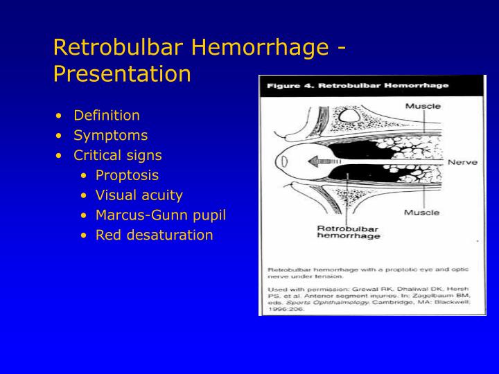 PPT - Orbital Trauma PowerPoint Presentation - ID:6737616
