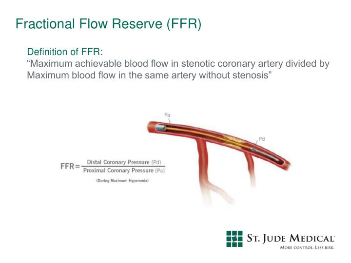 PPT - FFR and PressureWire ™ Certus PowerPoint Presentation - ID:6739283