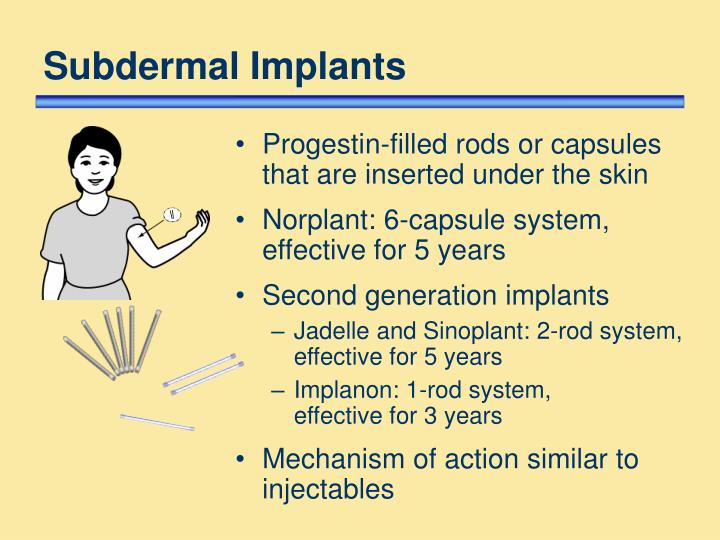 PPT - Contraceptive Options for Women and Couples with HIV Implants ...