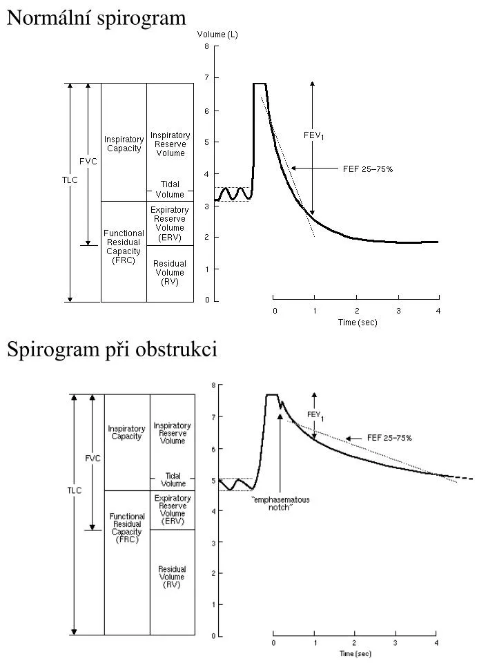 PPT - Normální spirogram PowerPoint Presentation, free download - ID ...