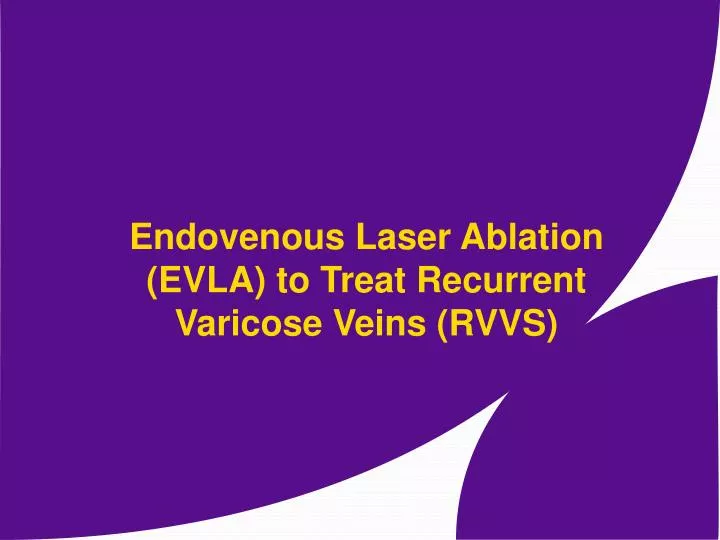 PPT - Endovenous Laser Ablation (EVLA) to Treat Recurrent Varicose ...