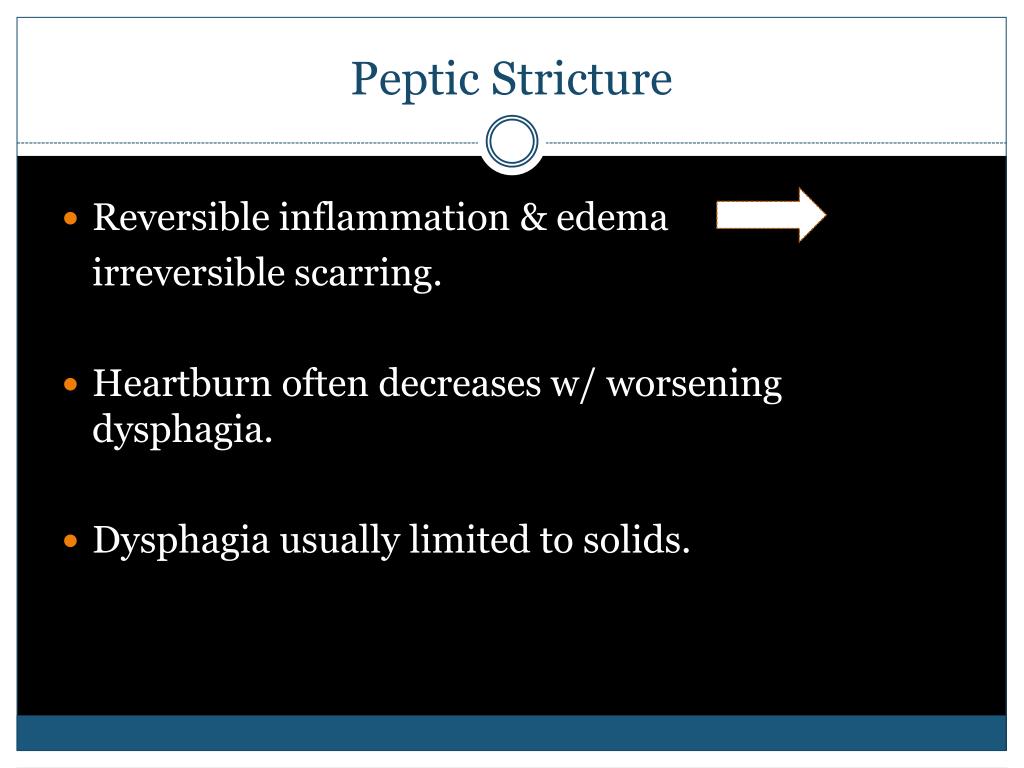 PPT - Putting Out the Fire: Prevention & Treatment of Acid Reflux ...