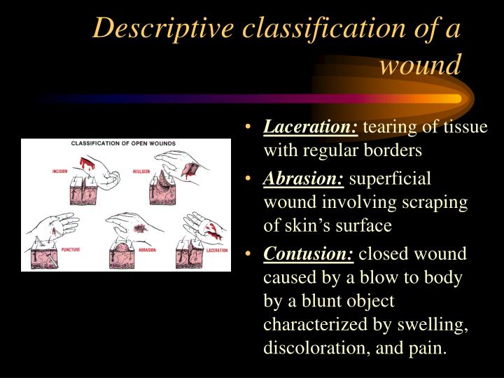 PPT - SURGICAL ASEPSIS & WOUND CARE PowerPoint Presentation - ID:6744202