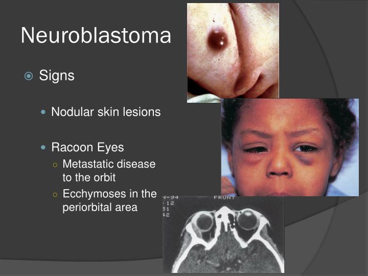 PPT - Pancytopenia PowerPoint Presentation - ID:6744321