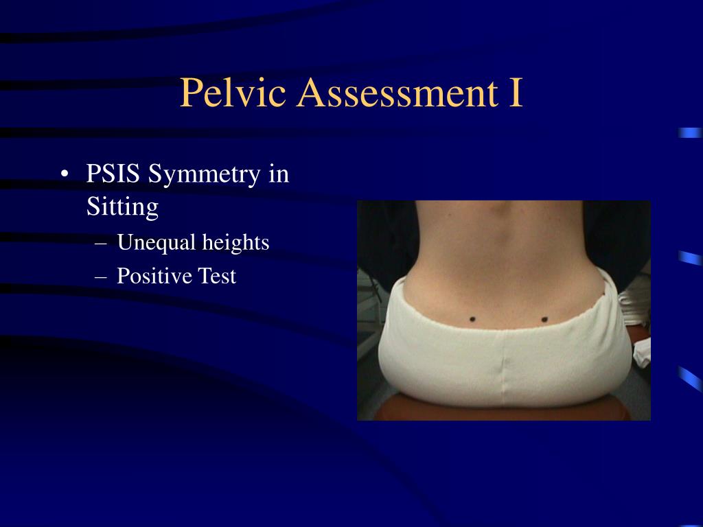 PPT - Evaluation and Treatment of the Acutely Injured Spine PowerPoint ...