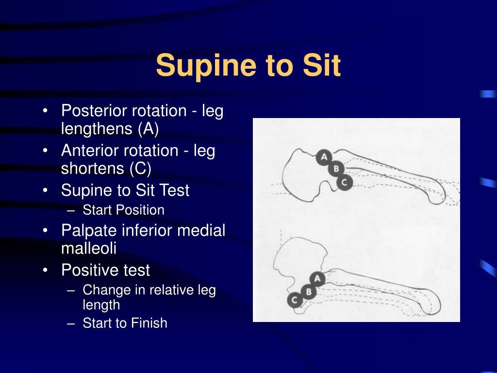 PPT - Evaluation and Treatment of the Acutely Injured Spine PowerPoint ...