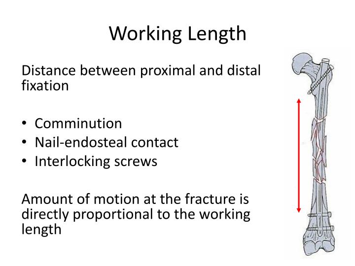 PPT - Intramedullary Nail Mechanics PowerPoint Presentation - ID:6745636
