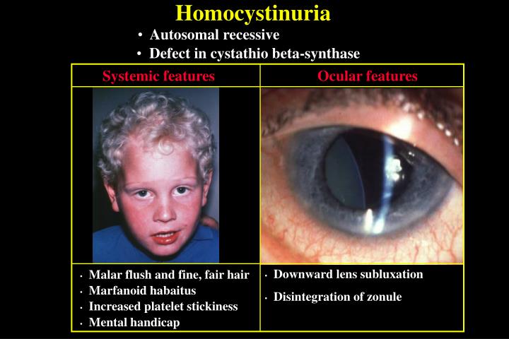 PPT - ECTOPIA LENTIS PowerPoint Presentation - ID:6747605