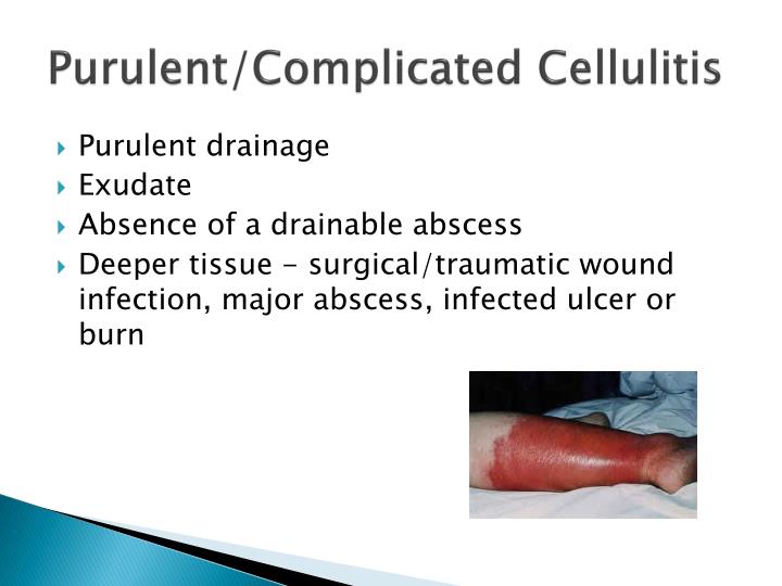PPT - Inpatient Skin and Soft Tissue Infections PowerPoint Presentation ...