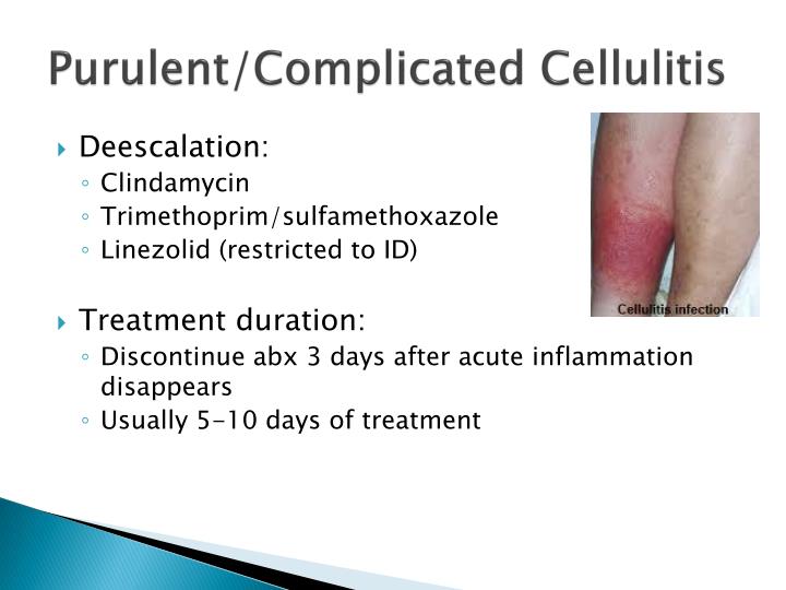 PPT - Inpatient Skin and Soft Tissue Infections PowerPoint Presentation ...
