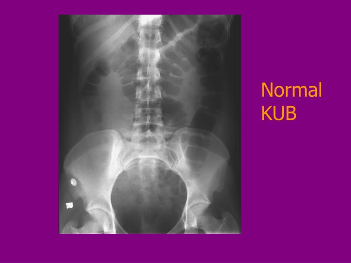 PPT - BASIC GI RADIOLOGY THE “FLAT” PLATE PowerPoint Presentation - ID ...