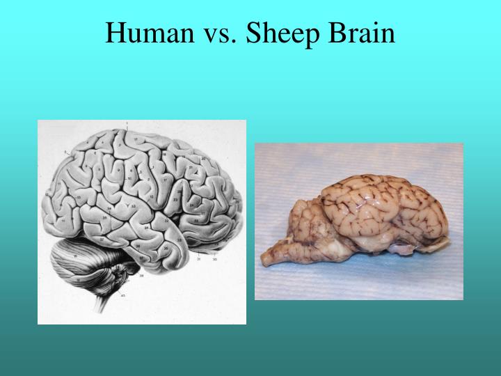 PPT - Electron Micrograph of Synapse PowerPoint Presentation - ID:6753375