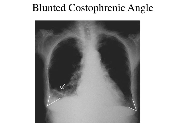 PPT - Principles of Radiology PowerPoint Presentation - ID:6760710