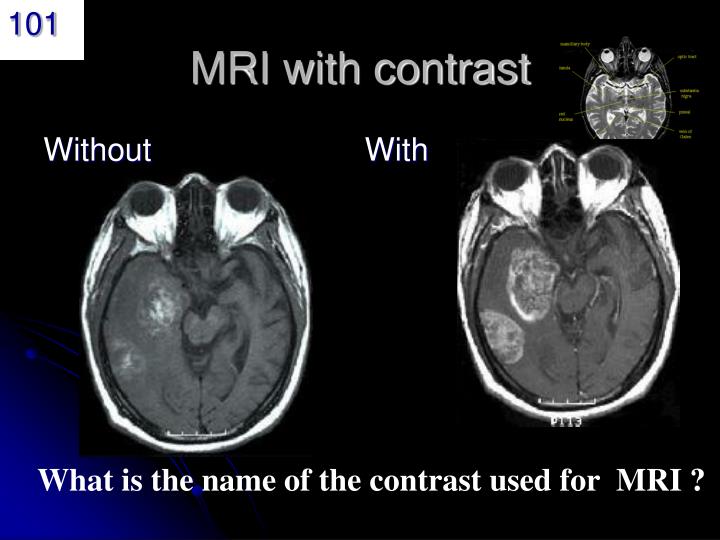 PPT - Radiographic Contrast Media PowerPoint Presentation - ID:6761362