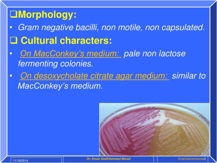 PPT - SHIGELLA & PROTEUS PowerPoint Presentation - ID:6763854