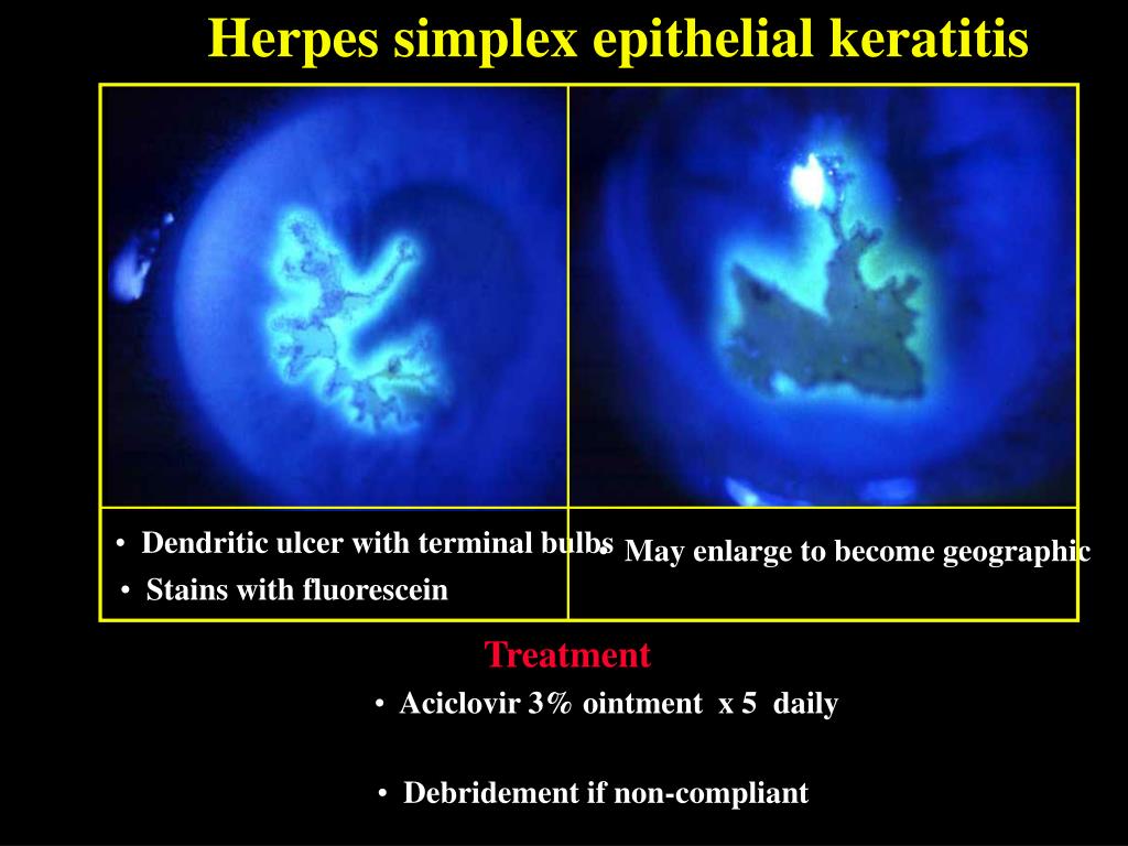 PPT - CENTRAL COAST DAY HOSPITAL OPTOMETRIST CONFERENCE - 26 FEBRUARY ...