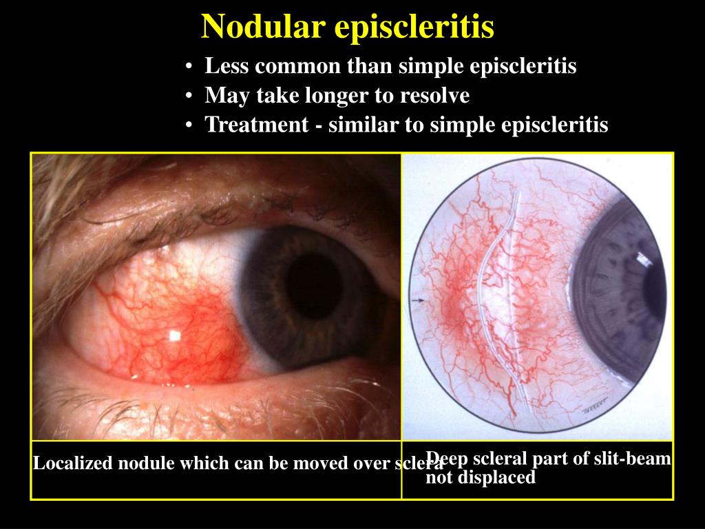 PPT - CENTRAL COAST DAY HOSPITAL OPTOMETRIST CONFERENCE - 26 FEBRUARY ...