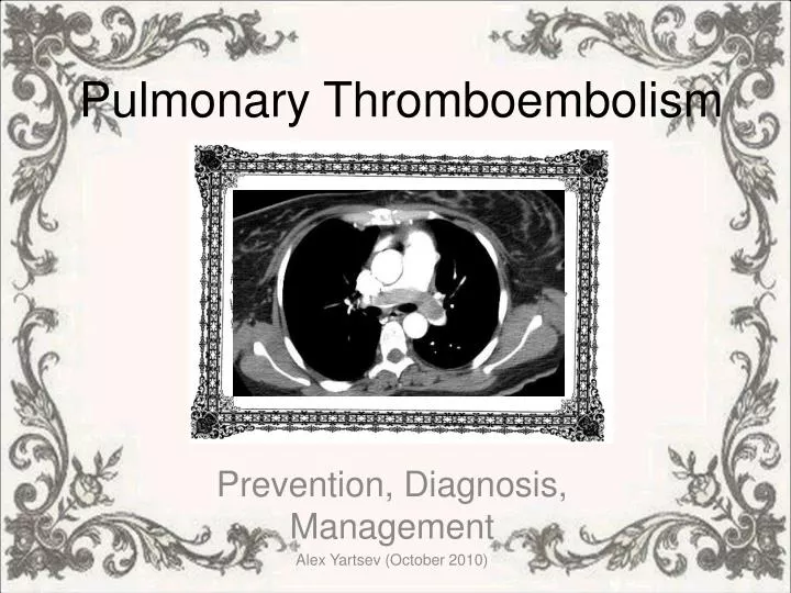 Ppt Pulmonary Thromboembolism Powerpoint Presentation Free Download