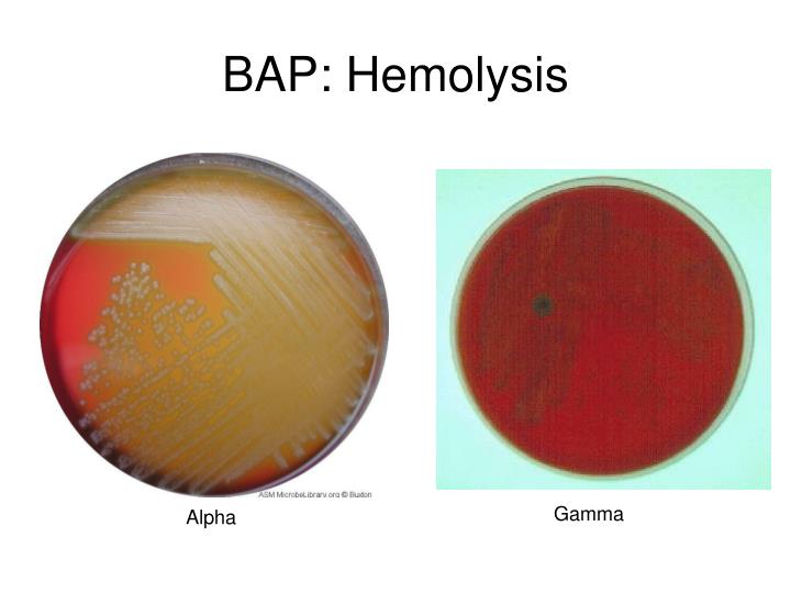 PPT - Staph and Strep PowerPoint Presentation - ID:6770788