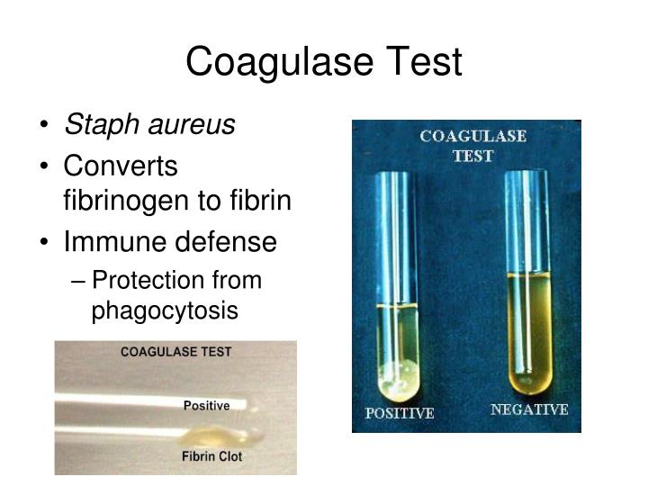 PPT - Staph and Strep PowerPoint Presentation - ID:6770788
