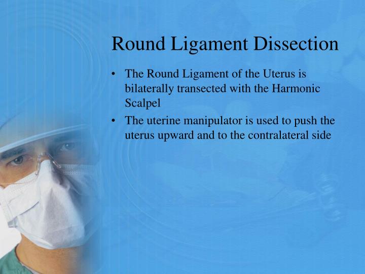 Causes Of Round Ligament Pain
