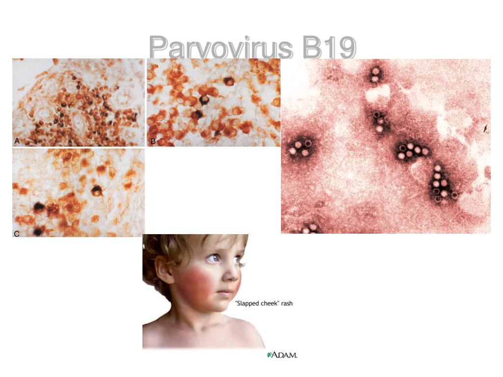 Ppt Viral Skin Infections Powerpoint Presentation Free Download Id