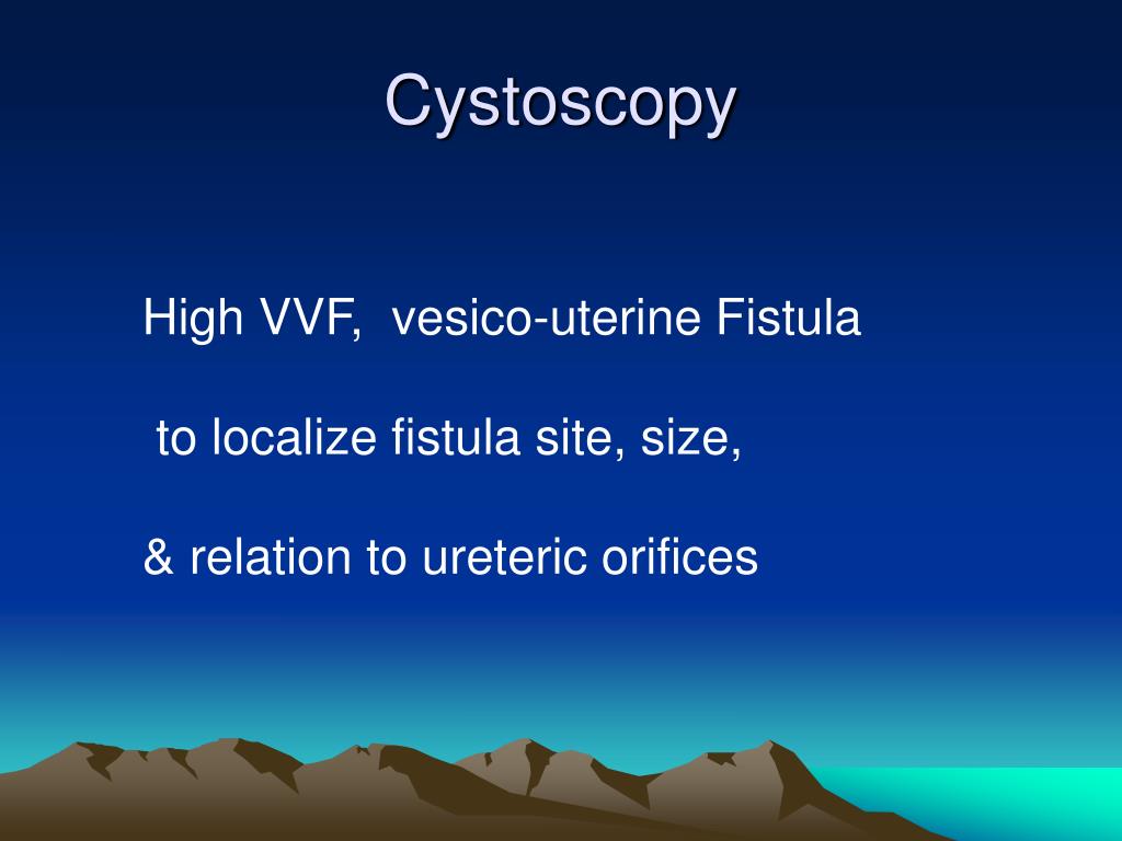 PPT - OBSTETRIC FISTULA IN AFRICA: Challenges to quality delivery of ...