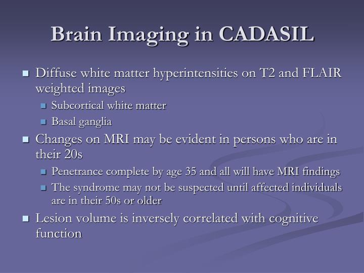 PPT - CADASIL PowerPoint Presentation - ID:6779560