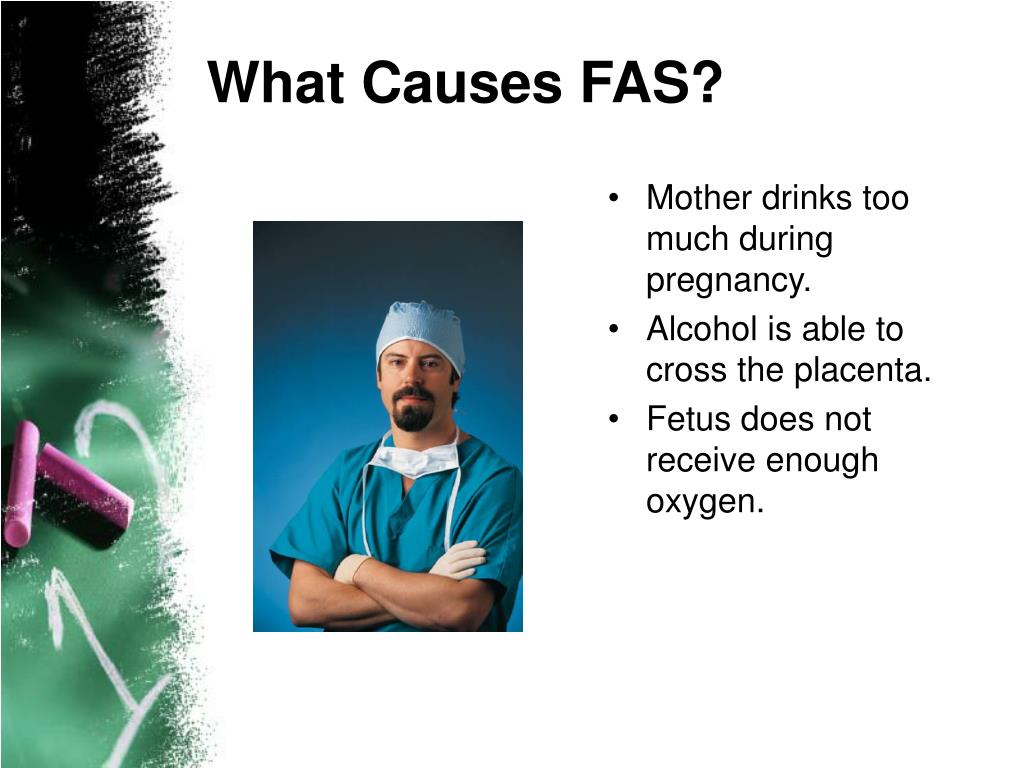 PPT - Fetal Alcohol Syndrome PowerPoint Presentation, free download ...