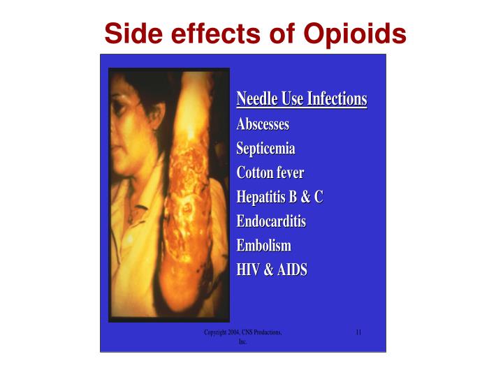 PPT - The Basics of Addiction: Drugs of Abuse PowerPoint Presentation ...