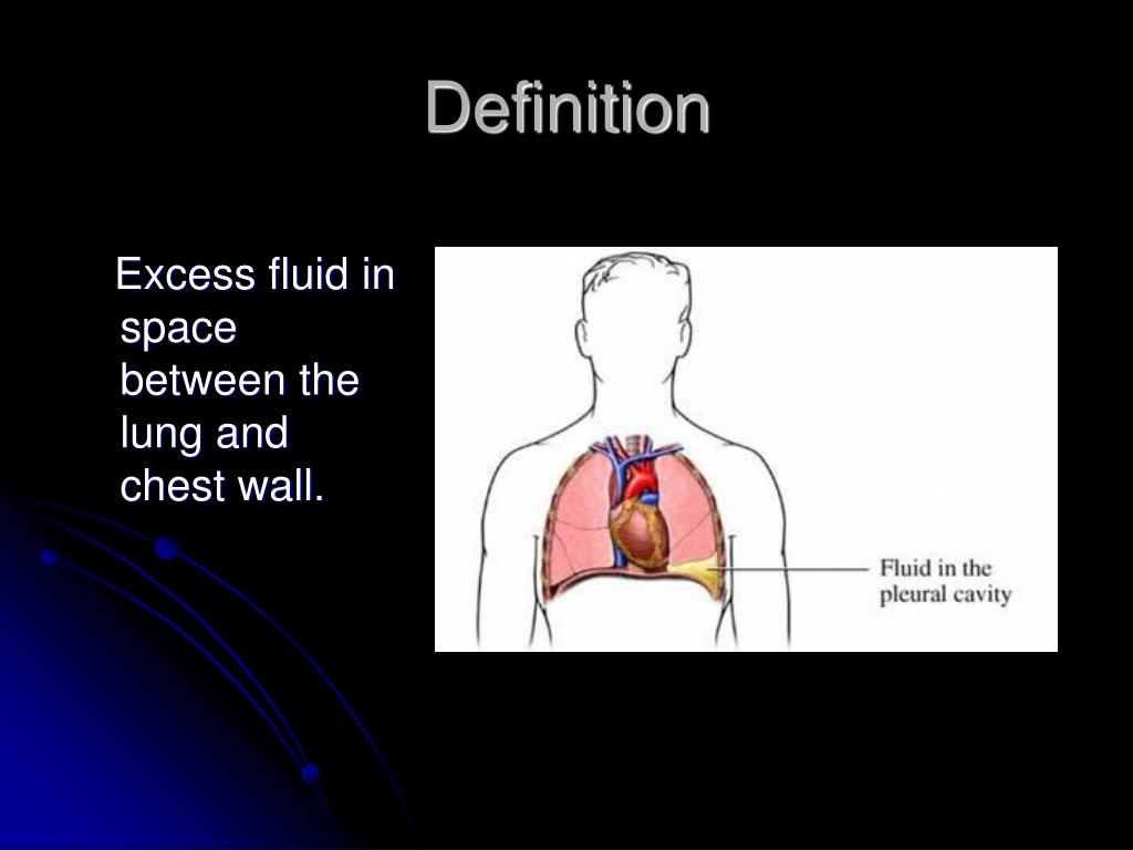 PPT - Pleural Effusions Internal Medicine AM Report Andrew Smitherman ...