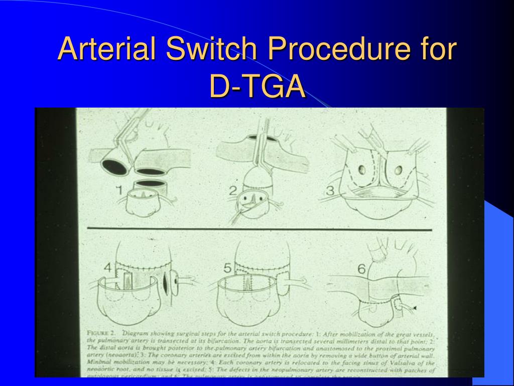 PPT - Diagnosis and Management of the Neonate With Critical Congenital ...