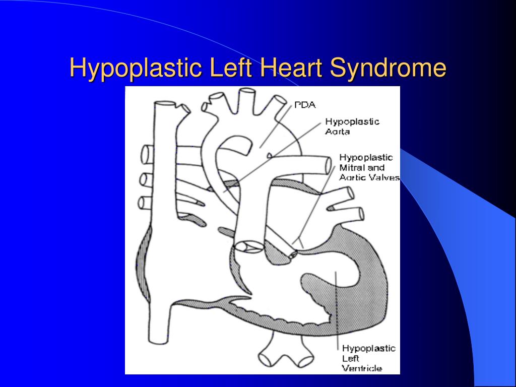 PPT - Diagnosis and Management of the Neonate With Critical Congenital ...