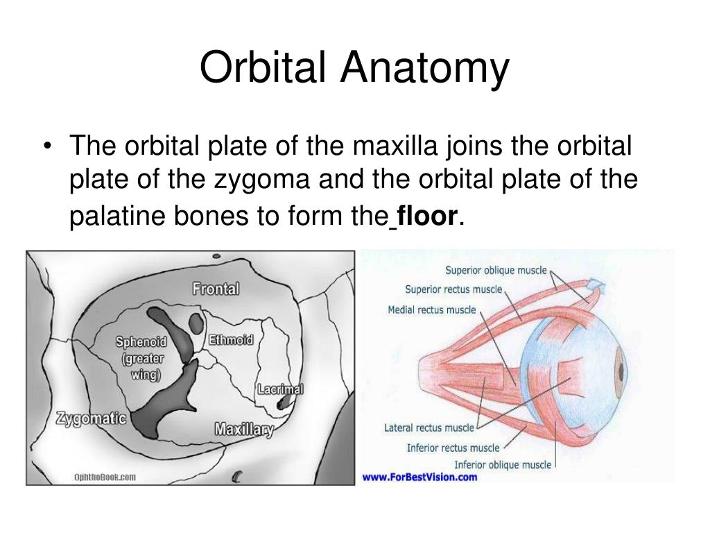 Ppt Orbital Blowout Fractures Powerpoint Presentation Free Download Id6789652