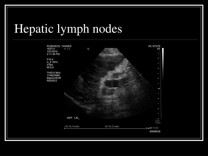 PPT - Bile Peritonitis PowerPoint Presentation - ID:6795438