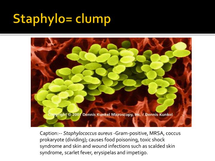 PPT - Bacterial Shapes and Groupings PowerPoint Presentation - ID:6799032