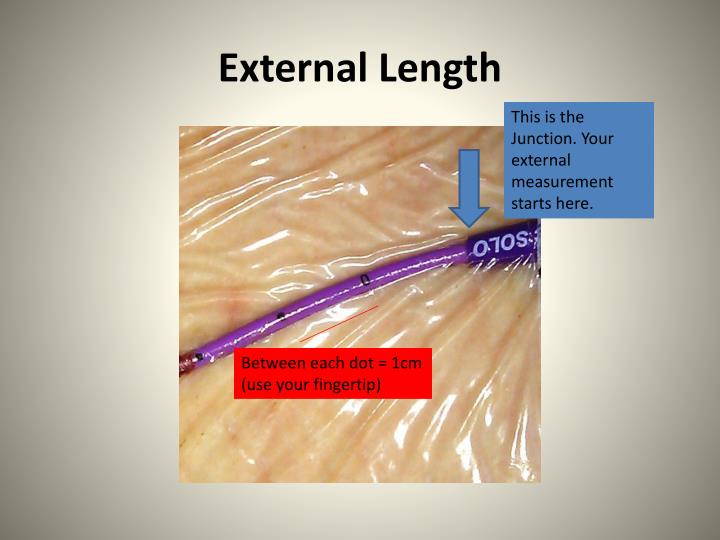 PPT - Vascular Access Plus (402) 449-9330 info@vascularaccessplus ...