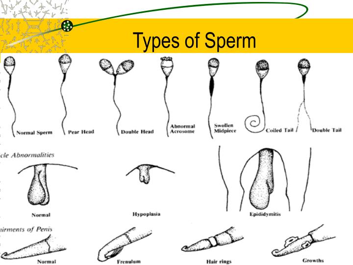 PPT - Male Reproductive Tract PowerPoint Presentation - ID:6800648