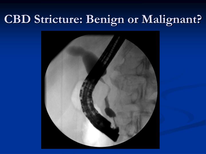 PPT - ERCP & Fluoro Quiz PowerPoint Presentation - ID:6818168